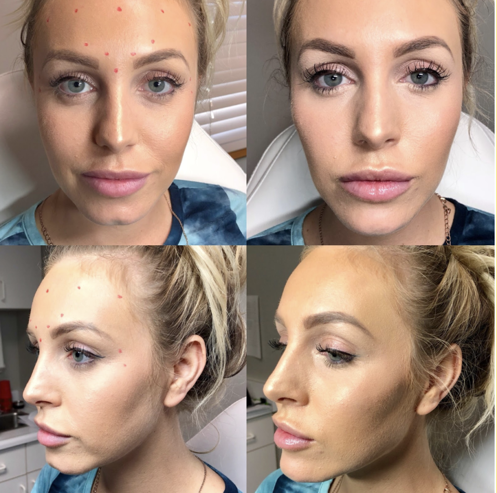 "Skin & Skinnier", San Diego Botox® Clinic | Dr. Steve Torres, MD